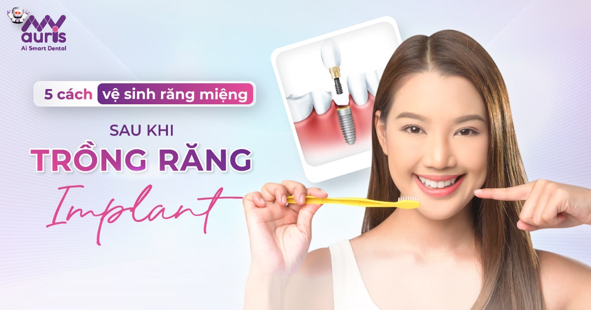 5 cách vệ sinh răng miệng sau khi trồng răng implant